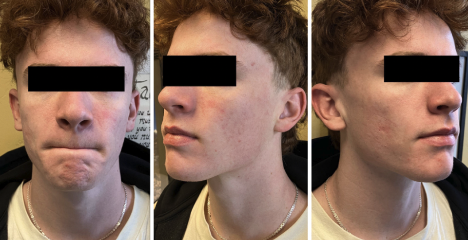 梅栏访 | 对话AOB Pharma公司总裁Todd Krueger：引领活菌药物治疗特应性皮炎的科研前沿_腾讯新闻