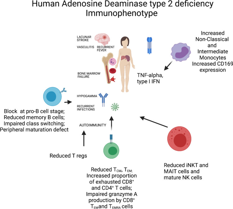 罕见病挑战（8）：DADA2的诊断与治疗_腾讯新闻