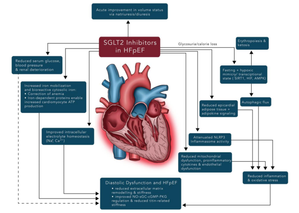 “跨界明星”SGLT2抑制剂，多机制协同治疗HFpEF_腾讯新闻