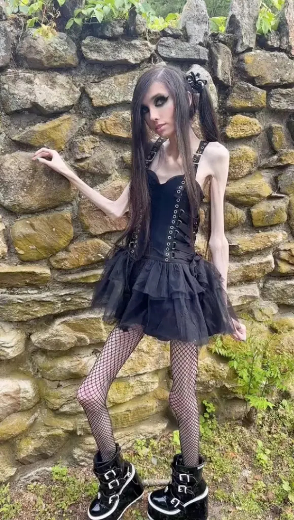 29岁厌食症女网红扮芭比惹争议，只剩皮包骨，有人同情有人要抵制_腾讯新闻