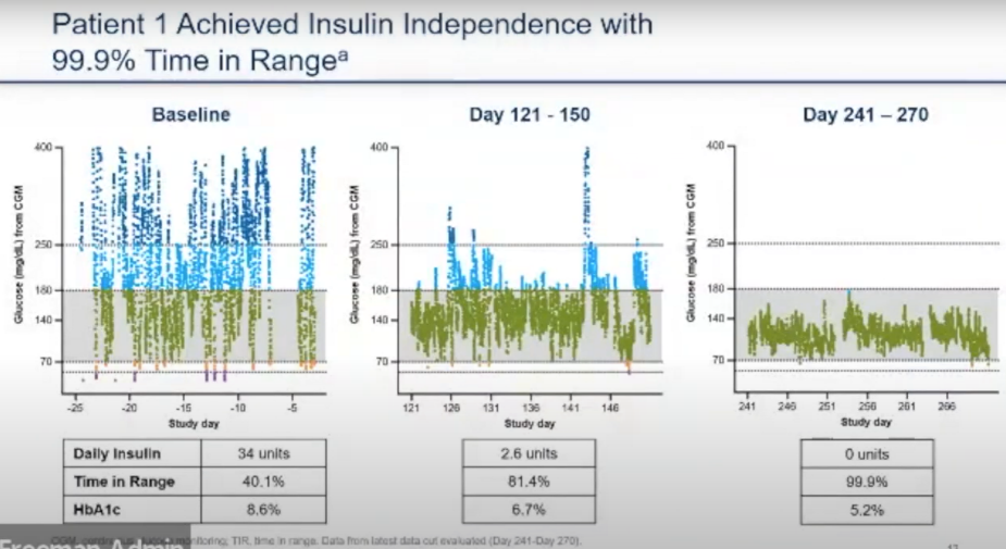 距离“治愈1型糖尿病”仅一步之遥？「VX-880干细胞疗法」最新数据亮相ADA | 2023ADA_腾讯新闻