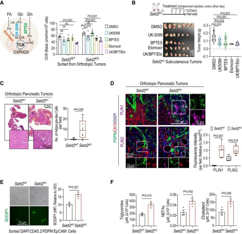 《癌细胞》：上海交大仁济医院团队领衔发现，肿瘤相关成纤维细胞是癌王的“加油站”！_腾讯新闻