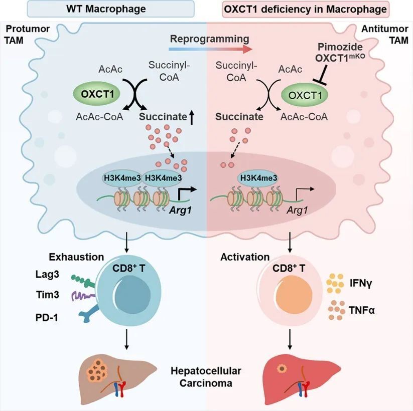 JOH丨抑制肿瘤相关巨噬细胞中OXCT1的活性为肝细胞癌治疗提供新策略_腾讯新闻