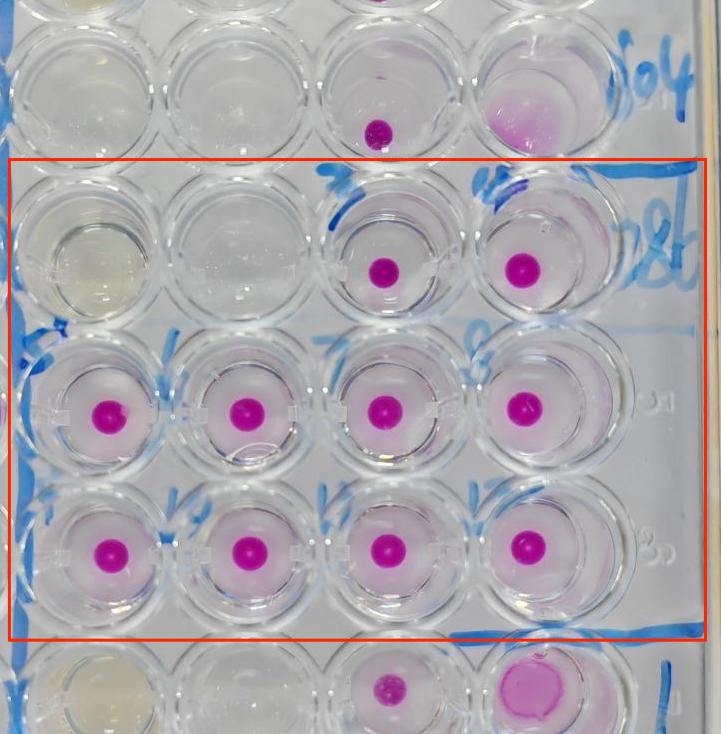 TP-Ab阴性、RPR阴性、TPPA阳性，怎么看？_腾讯新闻