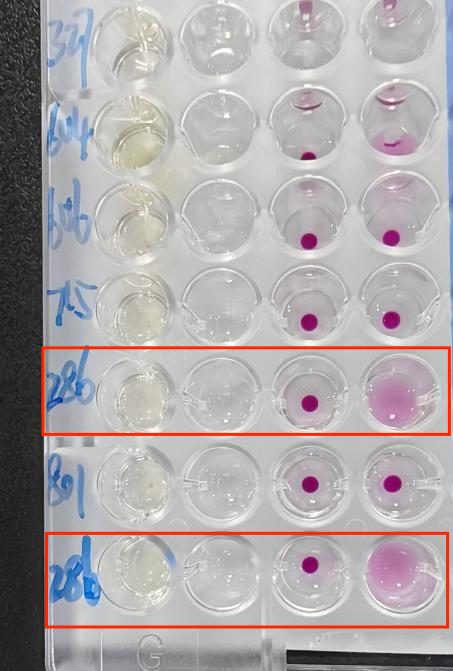TP-Ab阴性、RPR阴性、TPPA阳性，怎么看？_腾讯新闻