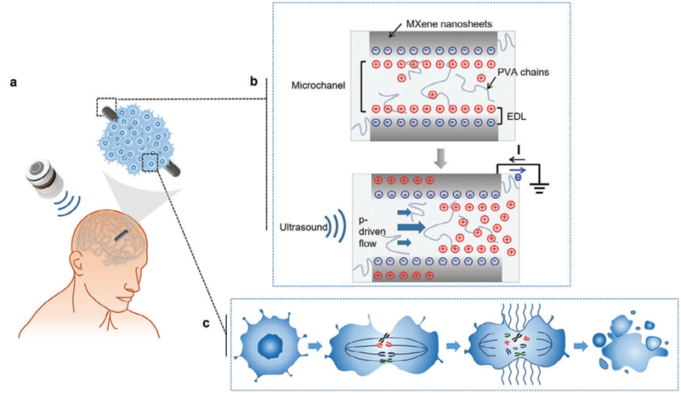 《Adv. Sci.》中山大学谢敬敦/徐炳哲：MXene/PVA水凝胶用于超声驱动的肿瘤治疗_腾讯新闻