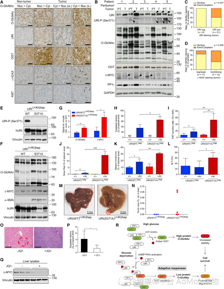 AbMole小课堂丨JQ1：BRD4抑制剂，在肿瘤、免疫和细胞分化研究中的应用_腾讯新闻