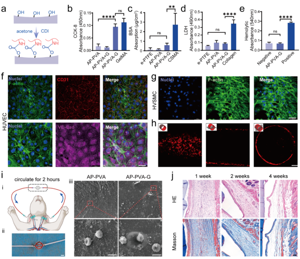 华工施雪涛、南科大刘吉ACS Nano: 3D打印强韧PVA基水凝胶构建功能性血管结构_腾讯新闻