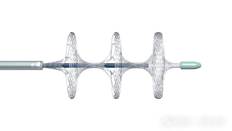 华创派 | 国内首创！腾复医疗Tendvia肺动脉取栓支架系统获得国家药品监督管理局（NMPA）批准上市_腾讯新闻