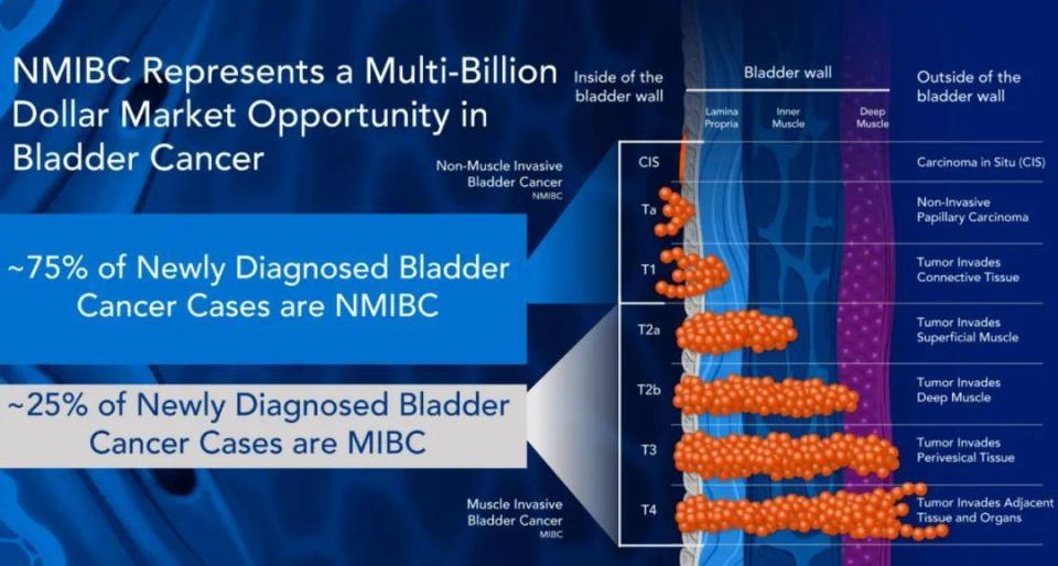 33岁华裔带领初创企业CG Oncology上市：市值22亿美元 主治膀胱癌_腾讯新闻