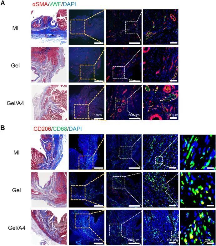 《Bioact. Mater.》可涂抹/缓释/粘附得水凝胶心脏补片用于梗塞心脏修复！_腾讯新闻