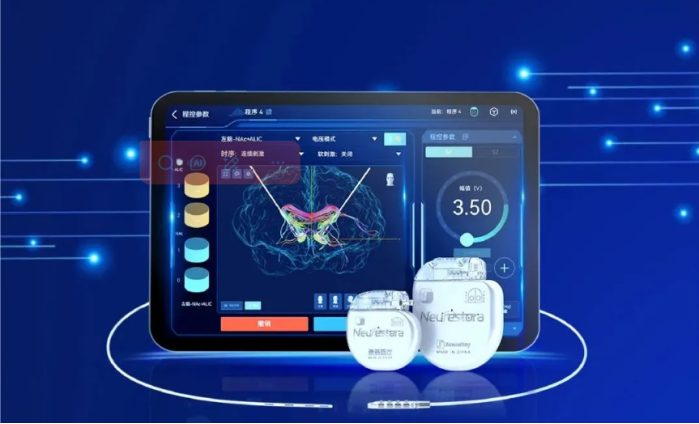 江苏省3款第三类创新医疗器械获批上市_腾讯新闻