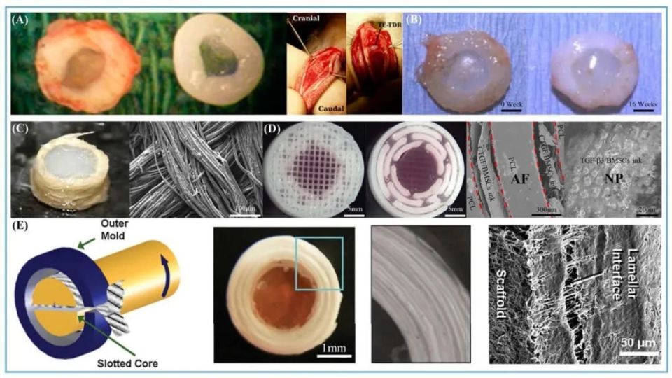 2.8万字！吉林大学任露泉院士团队《Prog. Mater. Sci.》顶刊综述：全椎间盘置换植入体的结构、材料、制造和性能_腾讯新闻