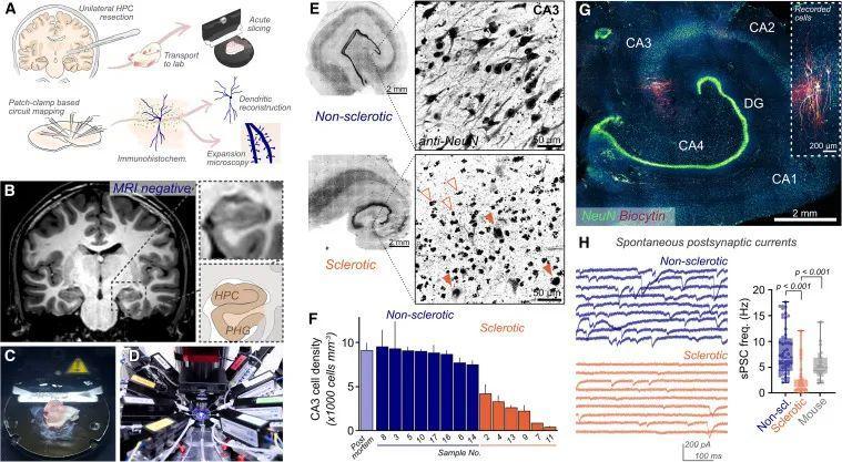 Cell | 记忆存储的未来：人类CA3研究如何推动人工智能与认知增强技术_腾讯新闻