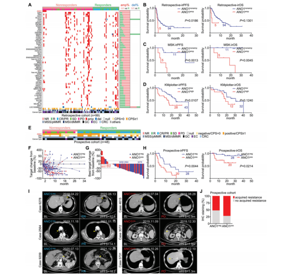 【深度解读】多组学+免疫荧光技术！揭秘ANO1在胃肠道肿瘤中的双重角色_腾讯新闻