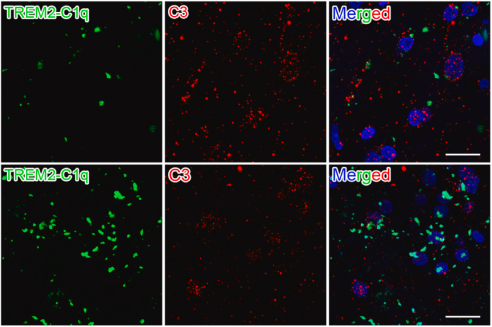 《免疫学》：厦大陈小芬/钟力团队破解小胶质细胞吞噬神经突触之迷_腾讯新闻