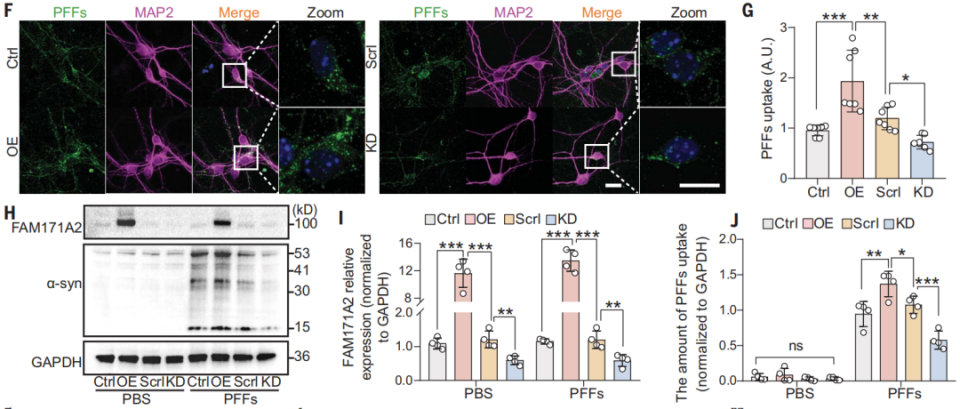 《科学》：发现帕金森病病理蛋白扩散关键！复旦华山团队找到帕金森病原始创新靶点，并找到潜在治疗药物_腾讯新闻
