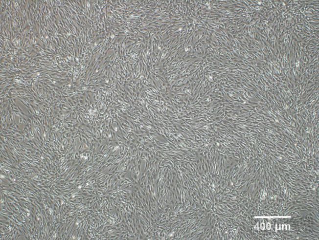 iPSC衍生MSC细胞疗法的成药之路在何处？_腾讯新闻
