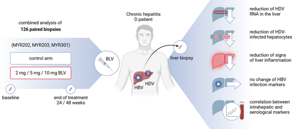 JOH：丁型肝炎新药bulevirtide延长治疗有望实现治愈_腾讯新闻