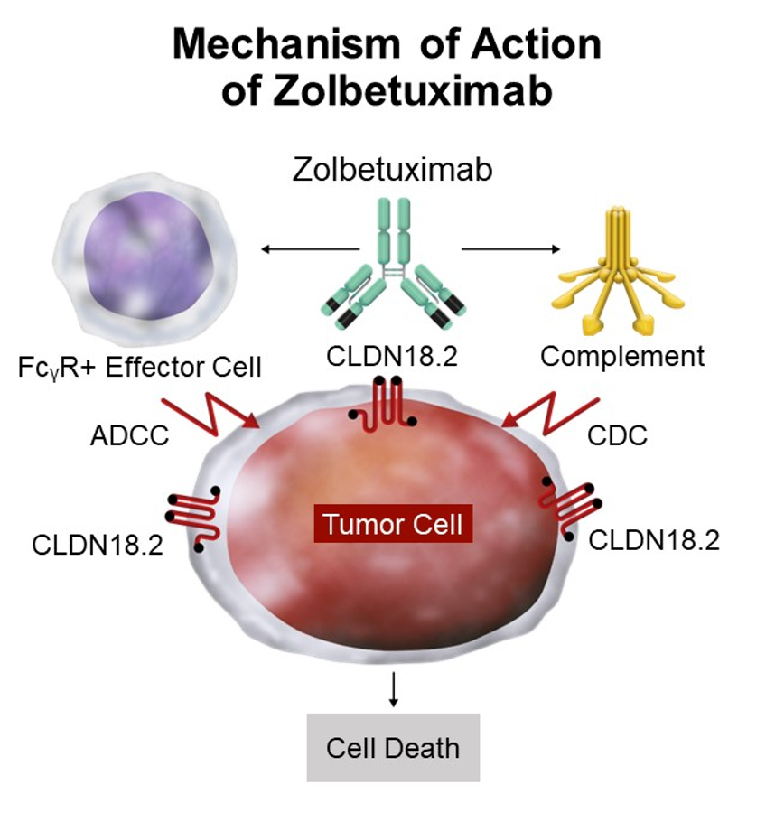徐瑞华教授：改变晚期胃癌治疗标准，Claudin 18.2 单抗登上 ASCO_腾讯新闻