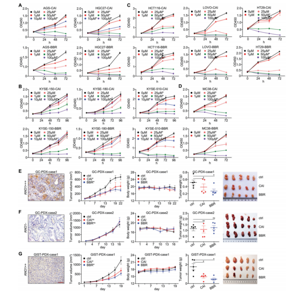 【深度解读】多组学+免疫荧光技术！揭秘ANO1在胃肠道肿瘤中的双重角色_腾讯新闻