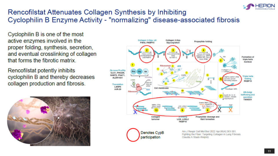 速递｜显著改善晚期NASH患者肝脏生理功能，新机制疗法达到2期临床终点_腾讯新闻