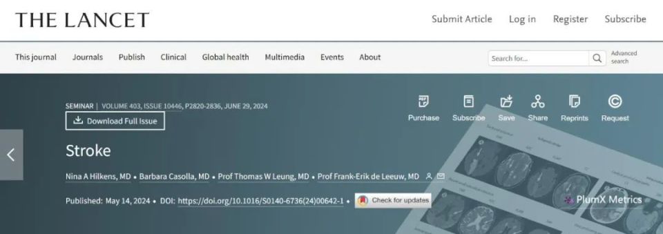 The Lancet：急性缺血性卒中治疗、二级预防进展和未来前景展望_腾讯新闻