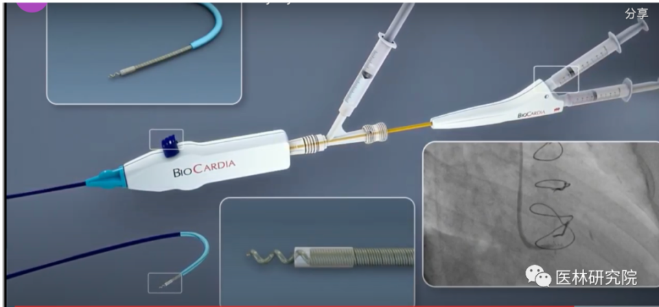 细胞疗法治疗心衰：BioCardia_腾讯新闻