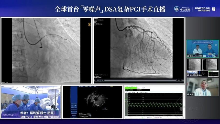 为医患大幅降低辐射，全球首台“零噪声”DSA心脏介入手术在中山医院完成_腾讯新闻