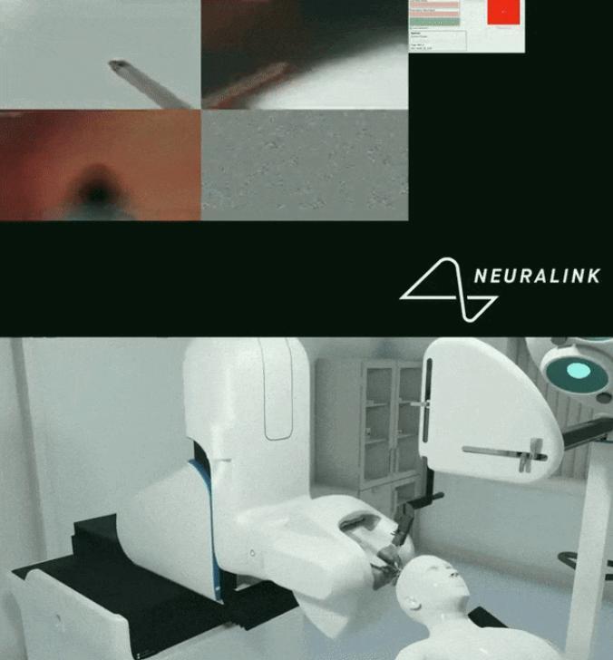 Neuralink完成首例人类脑机接口植入，还有千人正在排队｜最前线_腾讯新闻