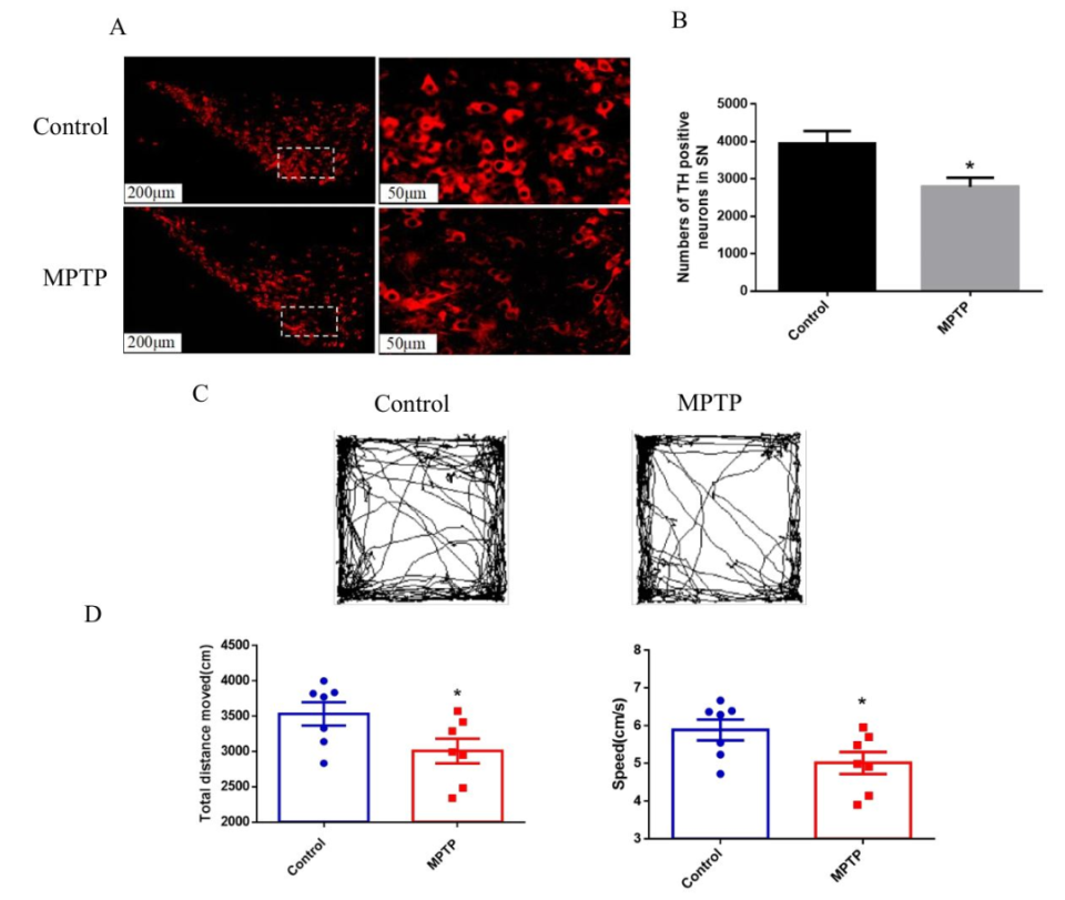 脑声问答（43）期丨MPTP诱导PD小鼠模型如何建立与评估_腾讯新闻