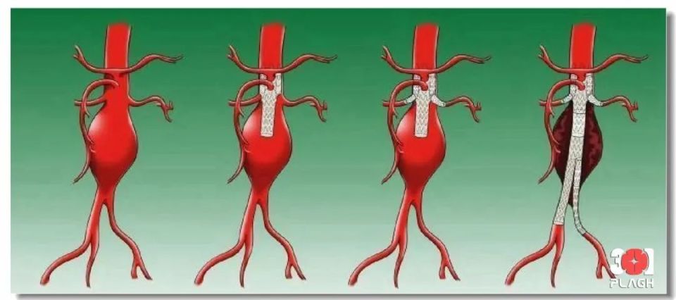 【微医讯】郭伟教授团队多项研究成果迎来新进展_腾讯新闻