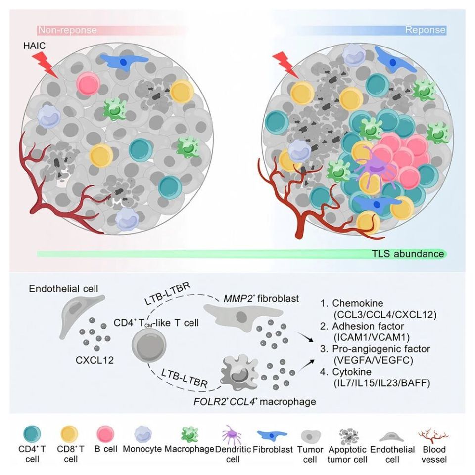 郑利民/韦玮/郭荣平团队Cell Rep Med：揭示三级淋巴结构的临床意义、功能特性及其形成机制_腾讯新闻