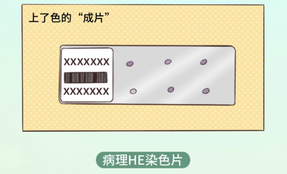 白片、HE切片、免疫组化切片都是啥？一文揭开“病理借片”的神秘面纱_腾讯新闻