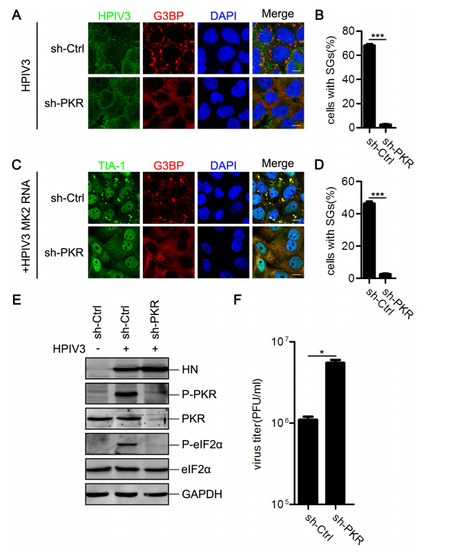 PloS Pathog.｜人 3 型副流感病毒包涵体通过屏蔽病毒 RNA 抑制抗病毒应激颗粒形成_腾讯新闻
