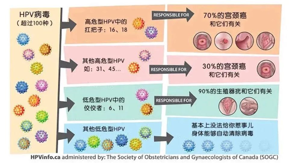 HPV阳性，2年后复查竟已高度病变！原因居然是……_腾讯新闻