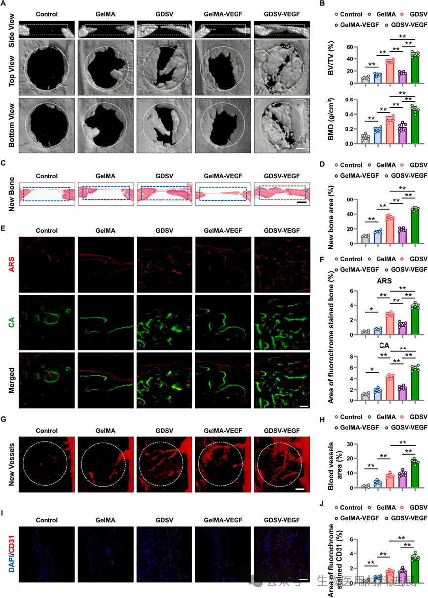《Bioact. Mater.》上交大仁济医院陆尔奕、王鹏飞：加速血管化骨再生的细胞外基质模拟复合水凝胶_腾讯新闻