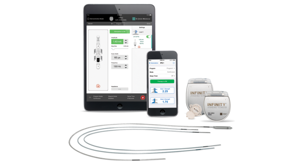 国产神经器械龙头，拟IPO_腾讯新闻
