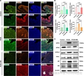 AbMole丨Dehydroepiandrosterone（DHEA）在代谢中的科研应用_腾讯新闻