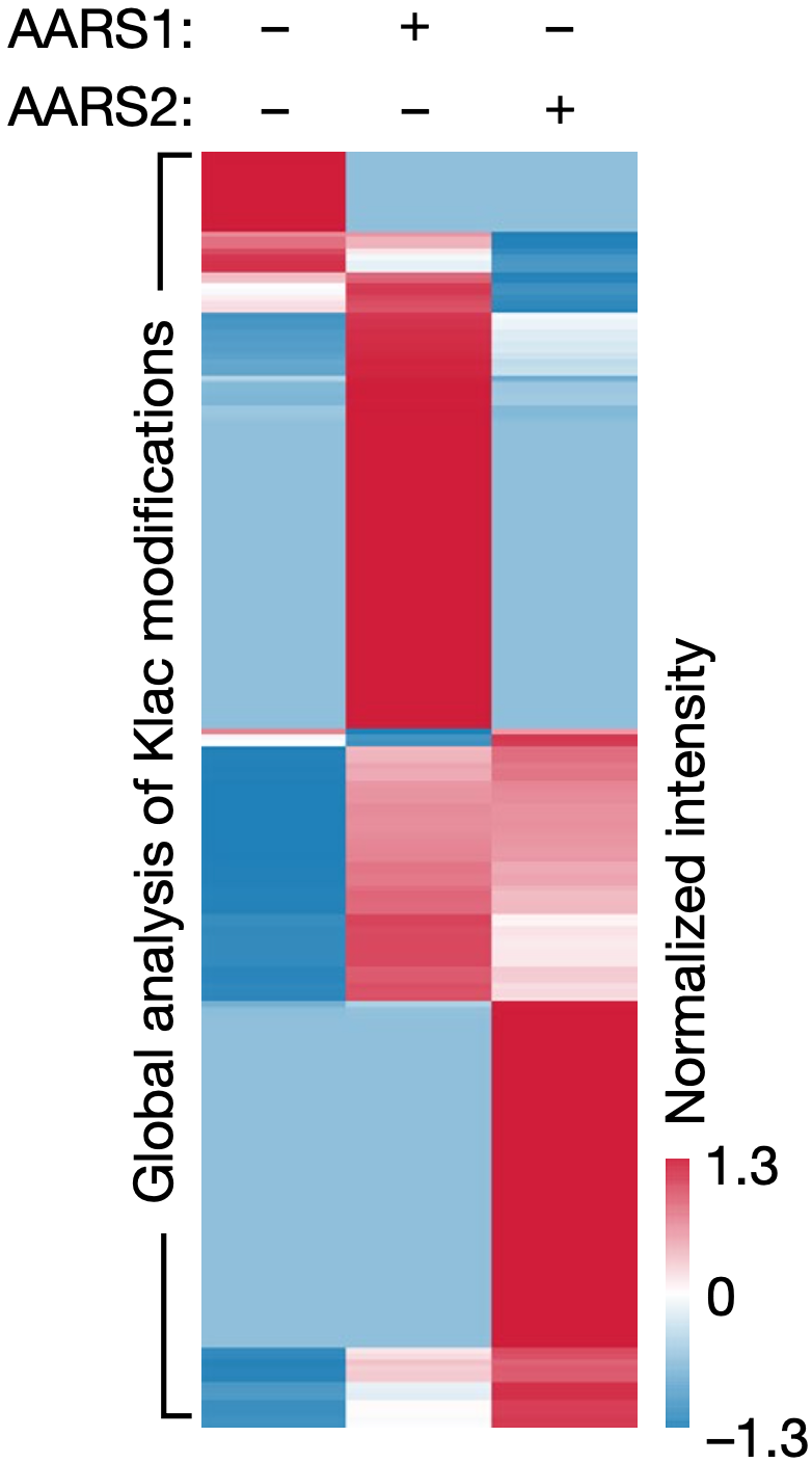 《自然》：乳酸真会伤免疫！浙大团队发现，高水平乳酸会将cGAS乳酸化，导致先天性免疫被抑制丨科学大发现_腾讯新闻