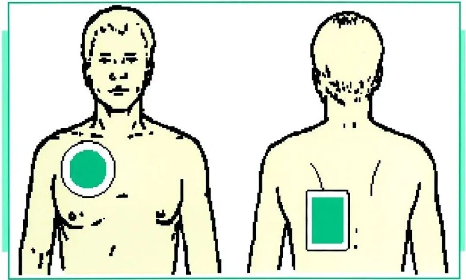 医生把手指伸入病人“后门”检查直肠，意外捅好了病人的心脏病_腾讯新闻