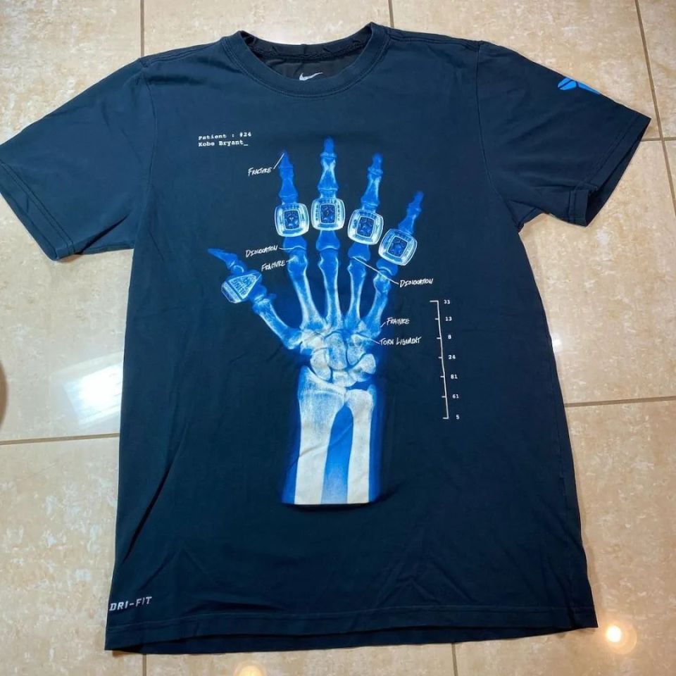 「X-Ray」Kobe 5 完整实物曝光！细节全看清了！_腾讯新闻