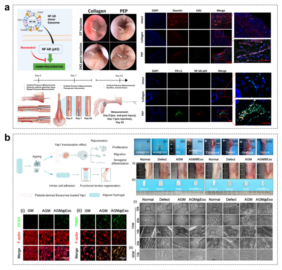 《Bioact. Mater.》四川大学华西医院解慧琪综述：组织工程中的水凝胶-外泌体系统——一种有前途的治疗策略_腾讯新闻