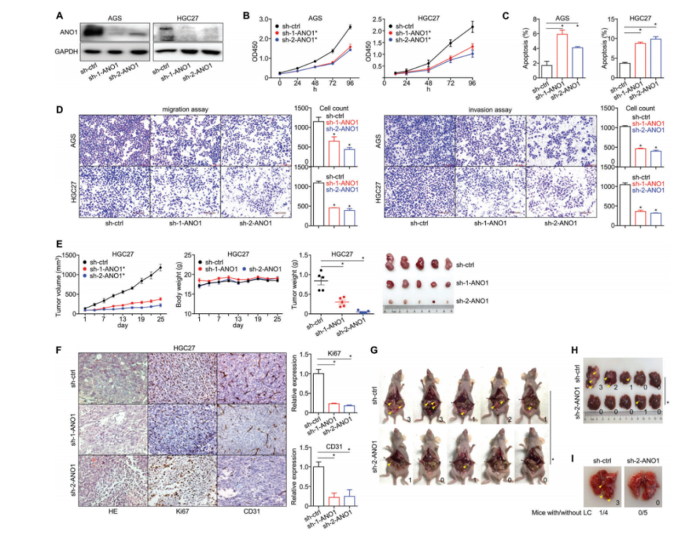 【深度解读】多组学+免疫荧光技术！揭秘ANO1在胃肠道肿瘤中的双重角色_腾讯新闻