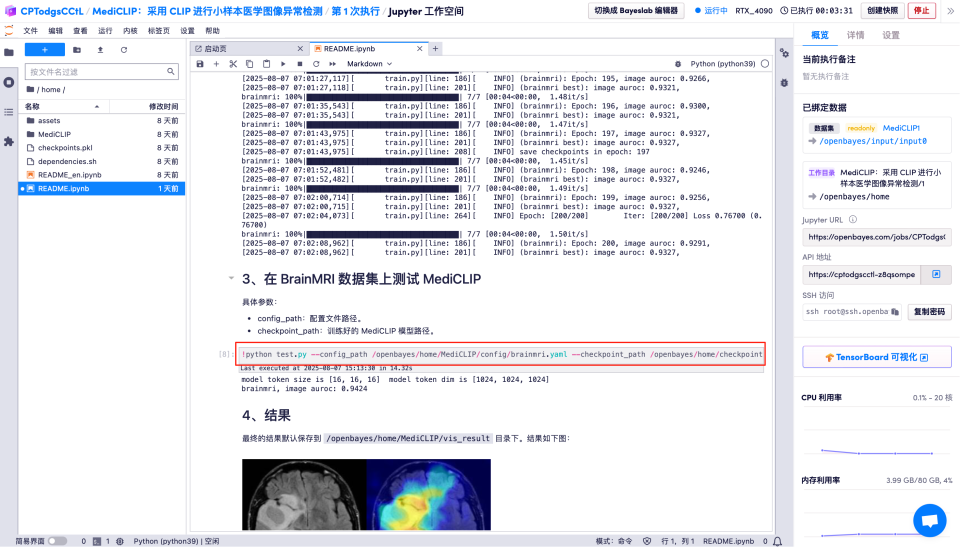 在线教程丨仅需极少量医学影像数据，MediCLIP在异常检测与定位任务中刷新SOTA_腾讯新闻
