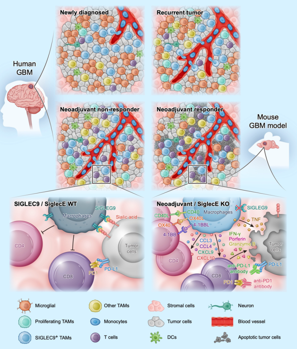 Nature Cancer | 陈俊团队揭示GBM新靶点：巨噬细胞免疫检查点Siglec-9_腾讯新闻