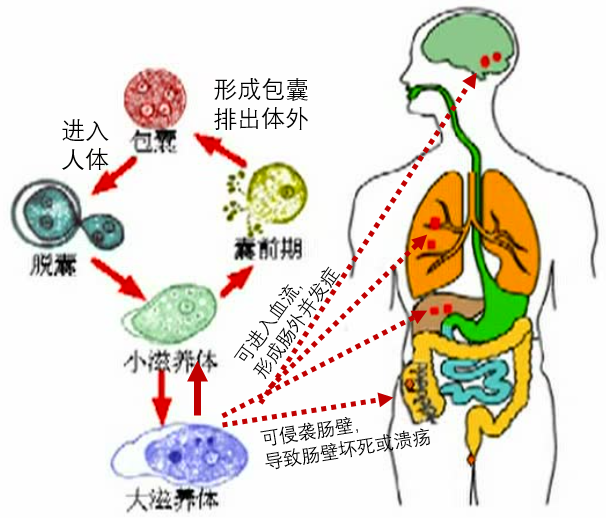 果酱样粘液血便？可能要小心阿米巴痢疾！ 腾讯新闻