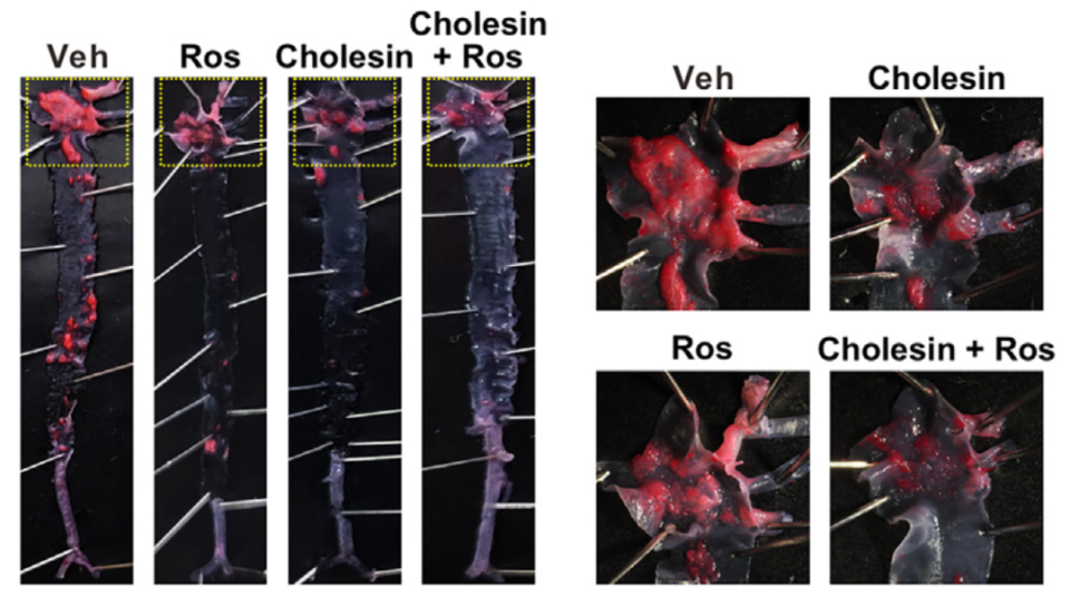 降脂新靶点登上《细胞》！王一国/张惠杰等发现调控胆固醇稳态的新激素_腾讯新闻