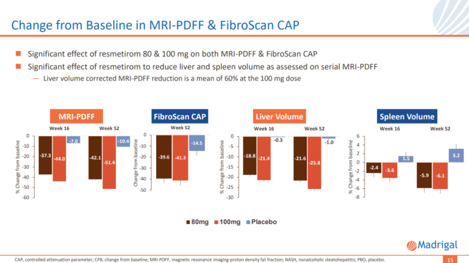 里程碑！首款NASH疗法获FDA批准_腾讯新闻