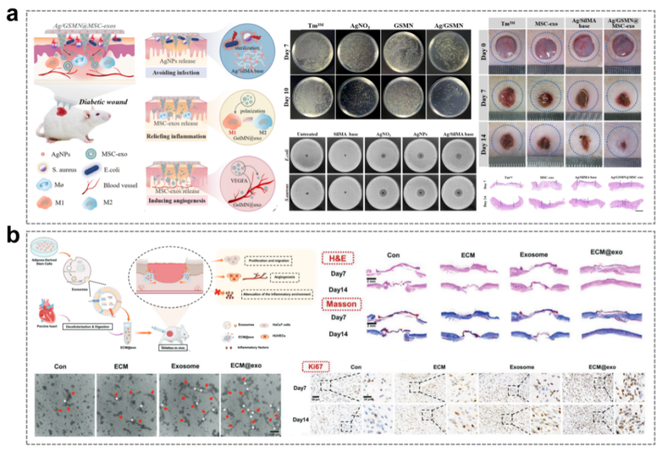 《Bioact. Mater.》四川大学华西医院解慧琪综述：组织工程中的水凝胶-外泌体系统——一种有前途的治疗策略_腾讯新闻
